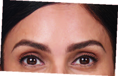 Cosmetic Botox® - Family Medical Specialties