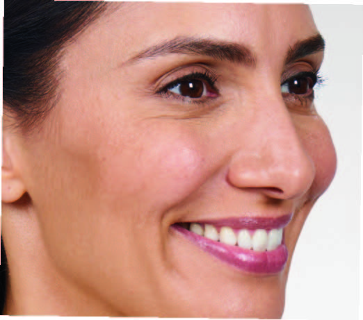 Cosmetic Botox® - Family Medical Specialties